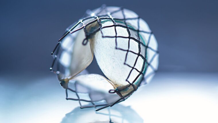 TAVI - transcatheter aortic valve implantation