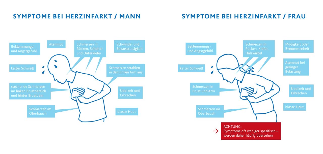 Herzinfarkt • Symptome, Ursachen, Diagnose und Therapie