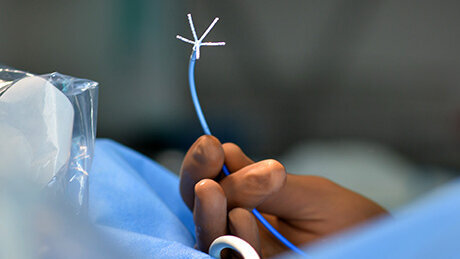 Elektrophysiologische Untersuchung (EPU) • Indikation, Ablauf, Vorteile ...