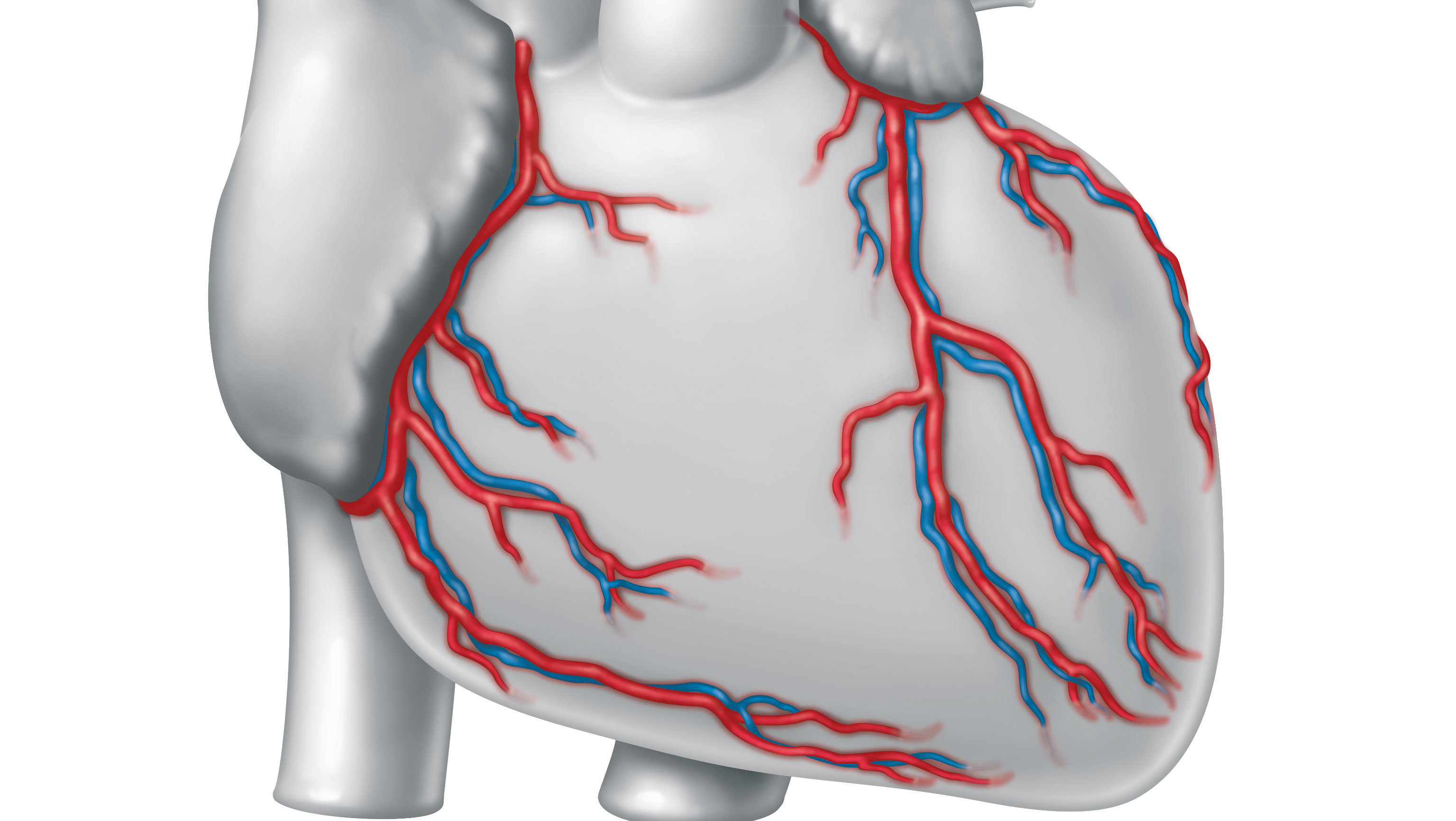 Koronare Herzkrankheit (KHK) • Ursache, Symptome, Behandlung - Deutsches Herzzentrum der Charité